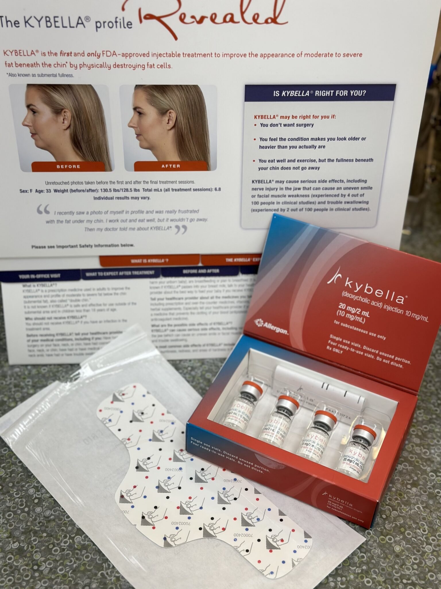 Non-Surgical Double Chin Removal with Kybella Injections