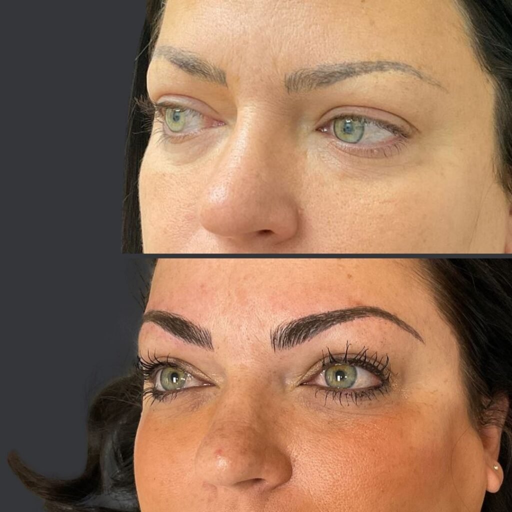 Patient 42671- Microblading - My Plastic Surgery Group